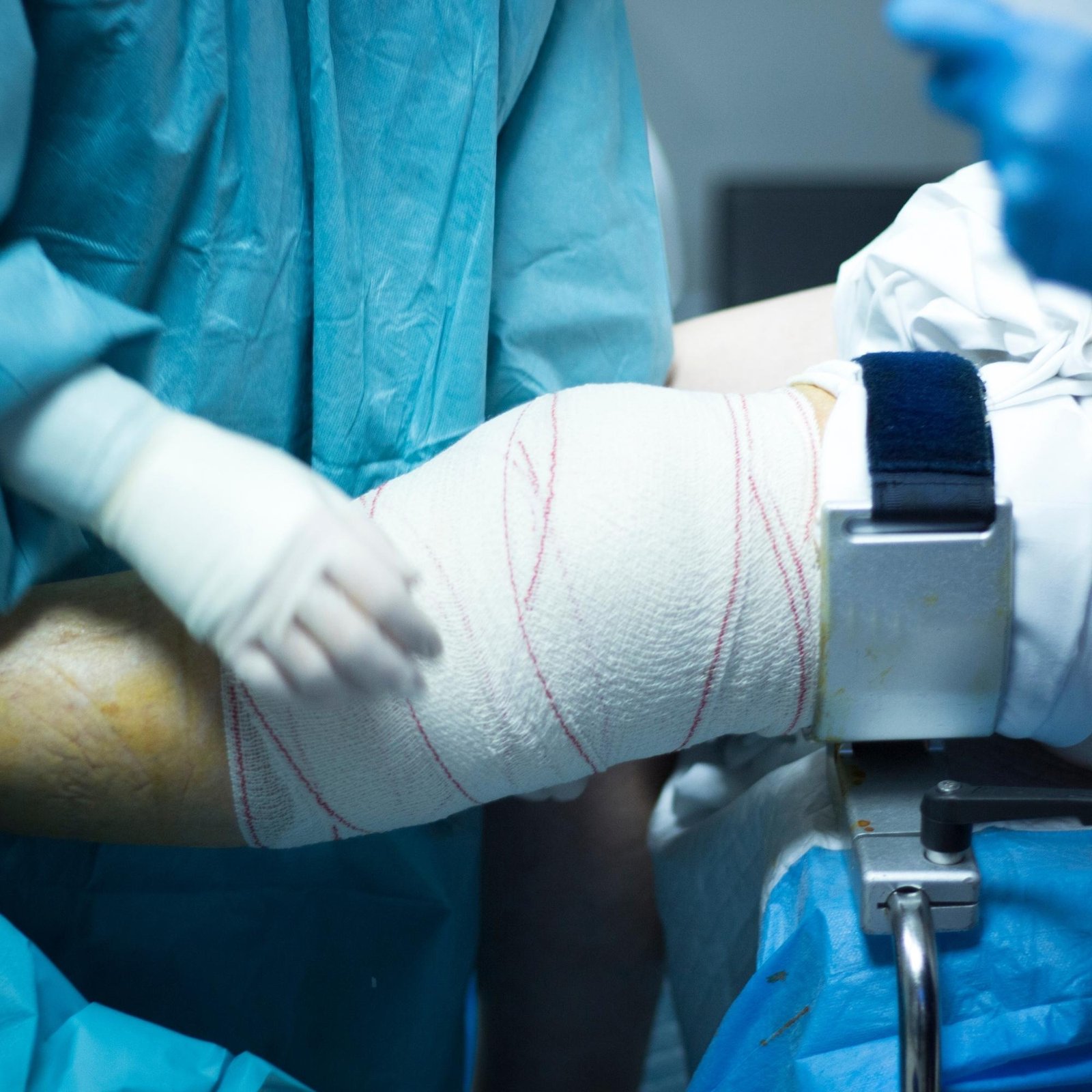 Ορθοπαιδικές Λοιμώξεις | Δρ. Αλκιβιάδης Καλλιβωκάς BSc, MD, PhD